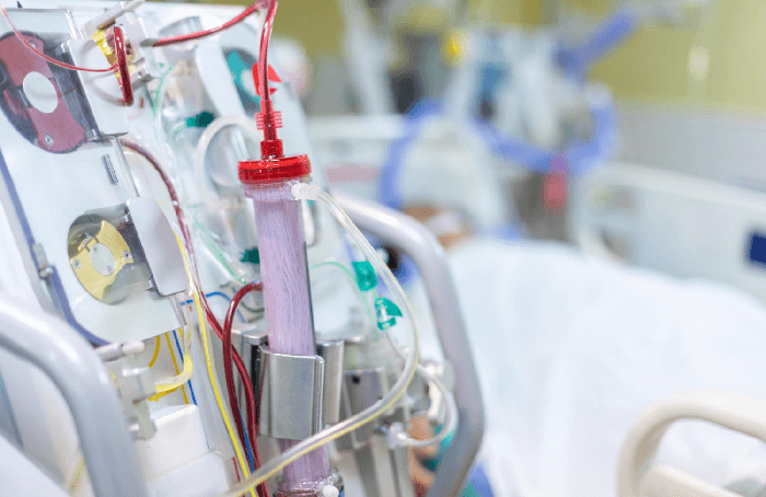 Colocación de catéter para hemodiálisis ofrecida por el Dr. Eduardo Cetina Pacheco: acceso ...